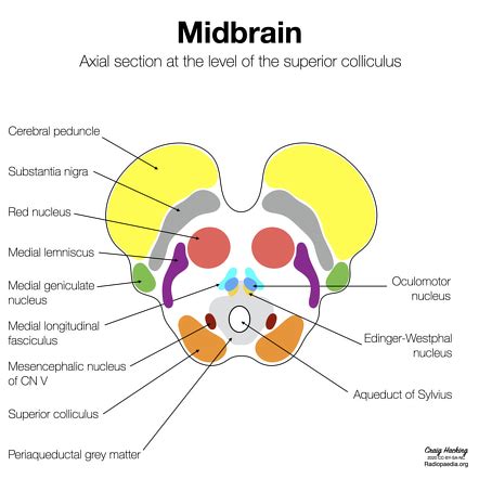Midbrain Radiology Reference Article