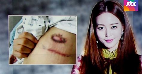 배우 한예슬 의료사고 당해 주장 보상조치 공방