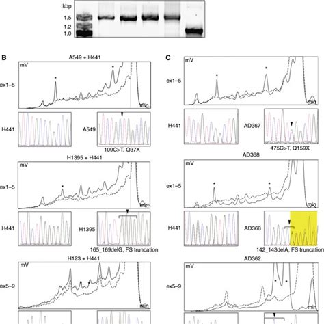 Mutation Analysis Of Lkb1 Gene In Nsclc Cell Lines And Tumours Rtpcr