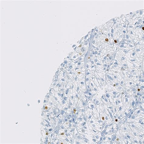 Misclassified Examples For The 18 Layer Resnet A And 34 Layer Resnet