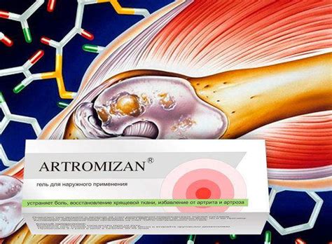 Artromizan гель для суставов, от артита, артроза, остеохондроза ...