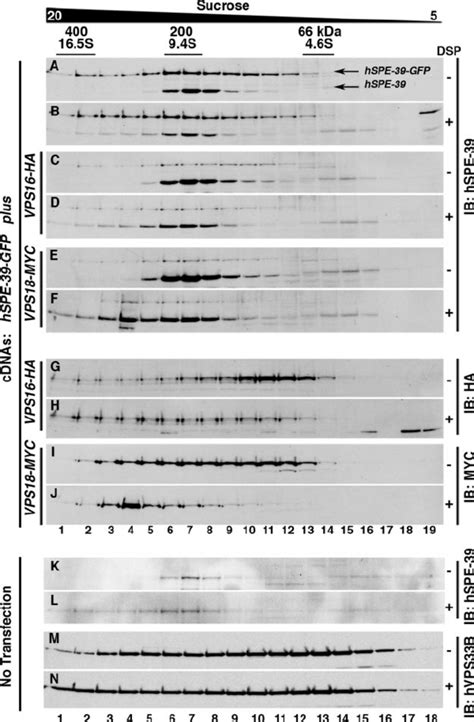 Hspe 39 And Hops Subunits Cosediment During Sucrose Gradient Download Scientific Diagram
