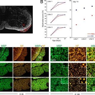 Myelination In The Peripheral Nervous System Of New Born Mice And The Download Scientific