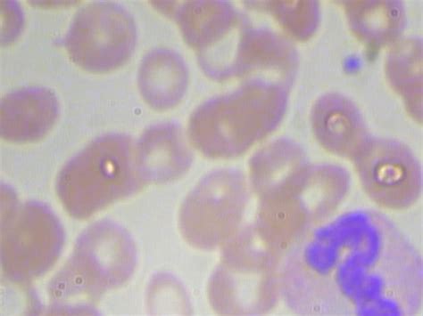 Blood Cells Object Detection Dataset By Siyamswe