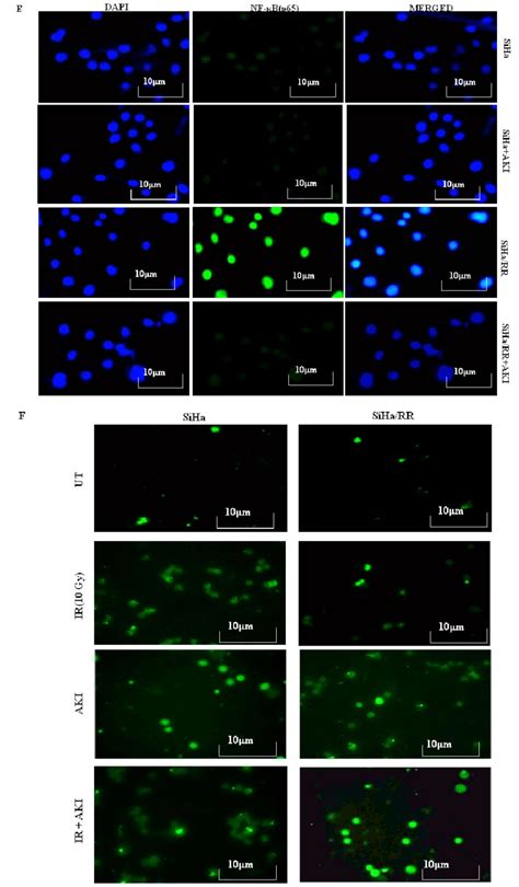 Aurka Inhibition Impedes Nfκb Signaling With Concomitant Prevention Of