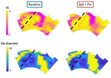 Figure S2 1 Spatial Maps Of Cc Between Recorded And Reconstructed Download Scientific Diagram