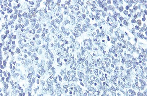 Antigen Unmasking Vectorlabs