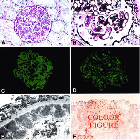 A Diffuse Wire Loops In The Absence Of Substantial Cellular Download Scientific Diagram