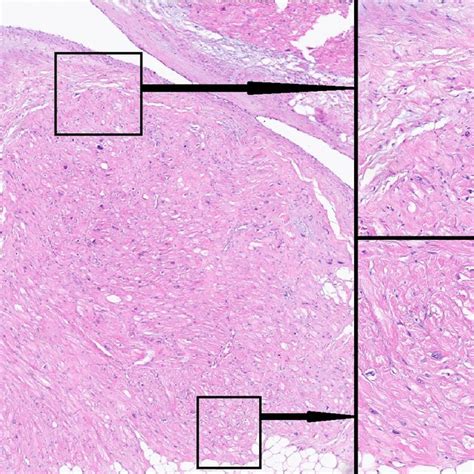 Technique 3 New Technology Used For Homogeneous Scar Tissue Creation Download Scientific