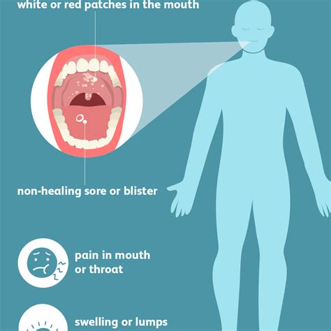 Early Sign Mouth Cancer