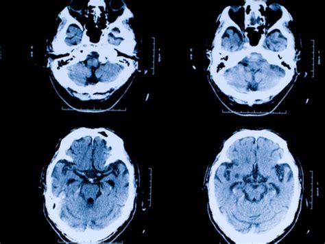 A Disease Detection Classification Segmentation Model For Medical