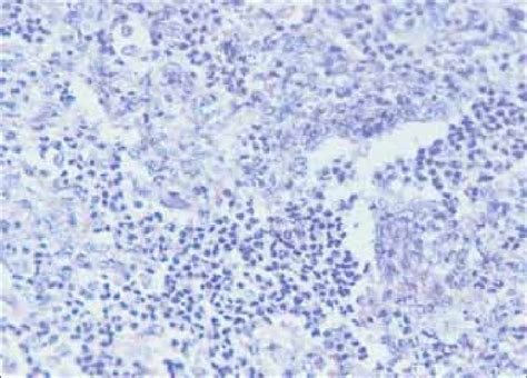 Microphotograph Showing Fibrinous Exudate And Flooding Of Download Scientific Diagram