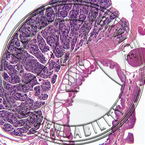 Earthworm Cross Section Seminal Vesicle Esophagus Intestine Prepared