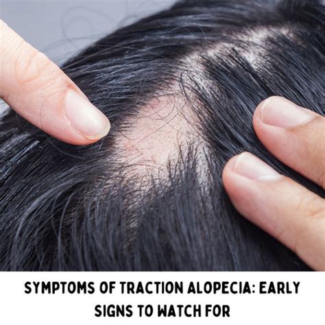 How To Prevent Traction Alopecia Essential Tips Clinikally