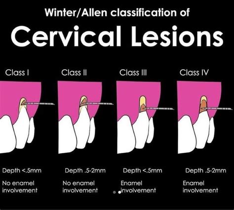 Cervical Lesions Classification Medizzy