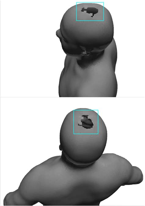 Sample Cavity In Scan In Area Of Head Download Scientific Diagram