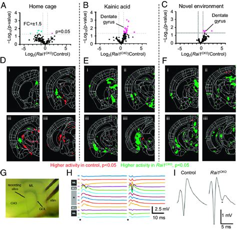Brain Wide Activity Mapping Uncovers Elevated Dentate Network Download Scientific Diagram