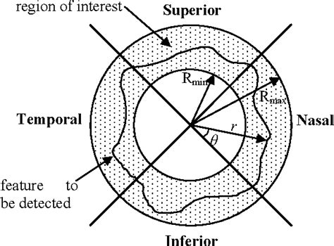 Figure 1 From Optic Nerve Head Segmentation Using Genetic Active