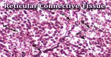 What Are The Types Of Reticular Cells Erlh