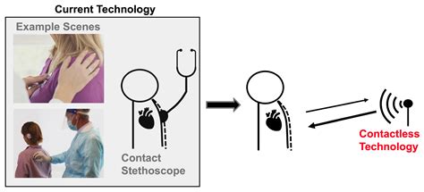 Contactless Stethoscope Enabled By Radar Technology