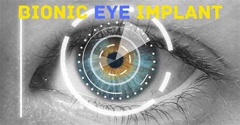 Bionic Eye E Tech Global Trends