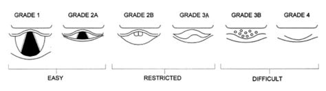 Cormack Lehane Grading Examples Openairway Cormack Lehane Grading Examples Openairway