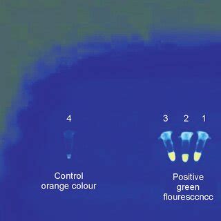 Visual Detection Of LAMP Amplified Products Under UV Light Tube 1 2 Download Scientific