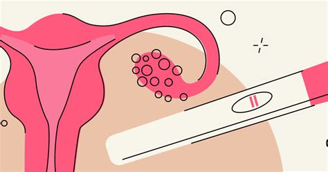 Bao lâu sau khi quan hệ tình dục sử dụng que thử thai sẽ cho kết quả chính xác nhất