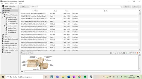 Image Occlusion Enhanced Cards Appear Twice Add Ons Anki Forums