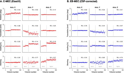 Transform Parameters From The Motion And Eddy Current Correction Versus