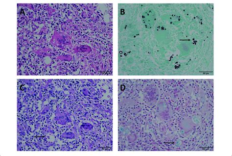 Mode A Gms Pas Ab In The Same View Of Lung Tissues With Download Scientific