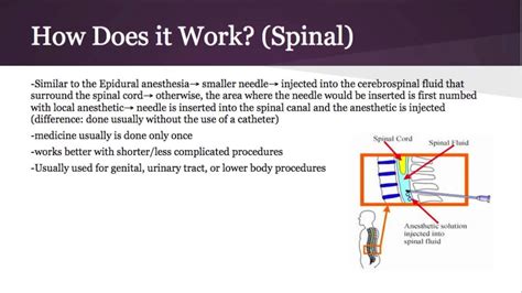 Spinal And Epidural Anesthesia Youtube