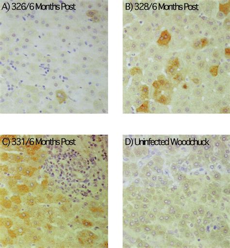 Viral Replication May Still Be Suppressed 6 Months After Adenovirus Download Scientific Diagram