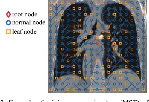Figure 2 From Mrf Based Deformable Registration And Ventilation Estimation Of Lung Ct Semantic