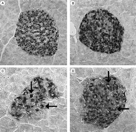 Cellular Localization Of Hepcidin In Rat Pancreas Immunohistochemical