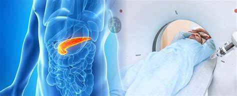 МРТ холангиопанкреатография — Медицинский центр в Махачкале «Целитель