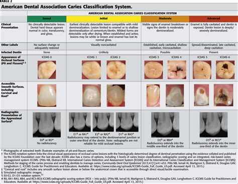 The American Dental Association Caries Classification System For Clinical Practice The Journal The American Dental Association Caries Classification System For Clinical Practice The Journal