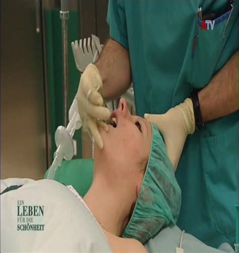 Intubation video 5 ThisVid com 日本語で Intubation video 5 ThisVid com 日本語で