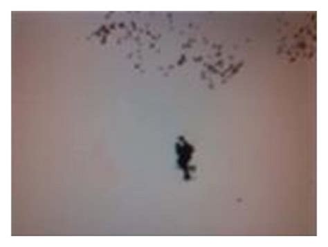 Effect Of Before And After Denoising Where A Is The Real Background