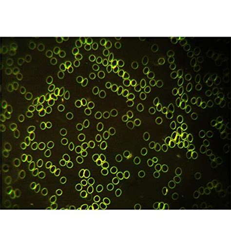 Omax Digital Darkfield Binocular Compound Microscope 40x 2000x With 3 0mp Usb Camera Black Jar