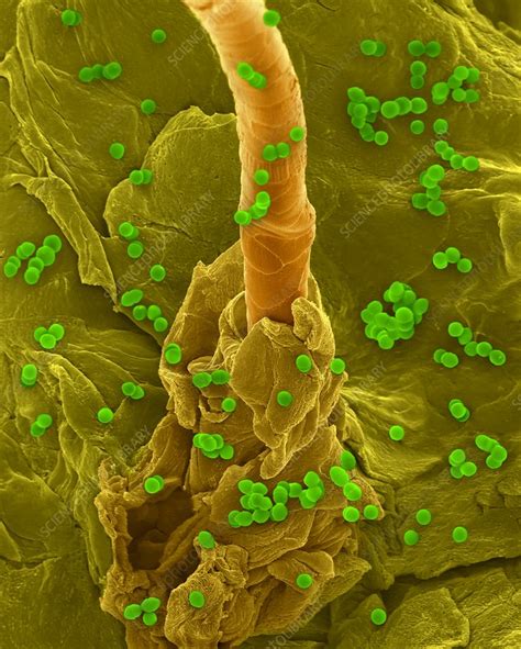 Enterococcus Faecium On Human Skin Sem Stock Image C0321920 Enterococcus Faecium On Human Skin Sem Stock Image C0321920