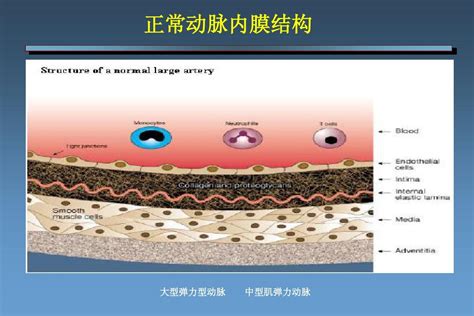 动脉粥样硬化的发生机制 Word文档在线阅读与下载 无忧文档