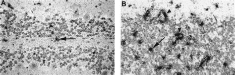RNA RNA In Situ Hybridization Of MuLV Infected Rat Brains MuLV RNA Download Scientific Diagram