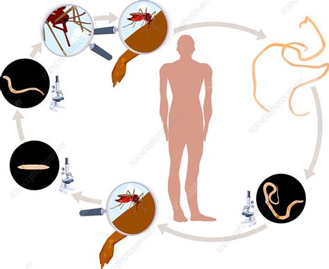 Lymphatic Filariasis Life Cycle