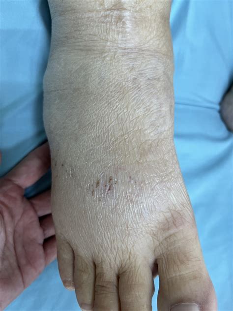 Sss Object Detection Dataset And Pre Trained Model By Project1