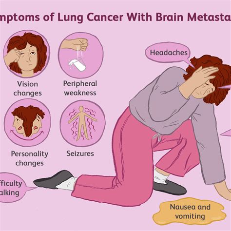 Lung Cancer Radiation Therapy Success Rate All About Radiation