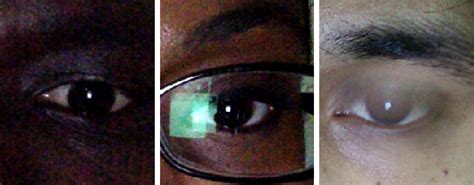 Figure 1 From On Fine Tuning Convolutional Neural Networks For Smartphone Based Ocular