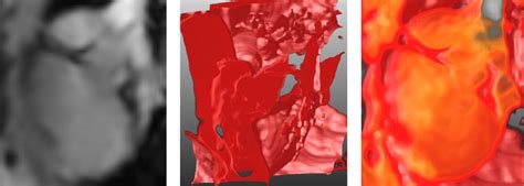 Context Visualizations Using The Magnitude Data Of The Pc Mri