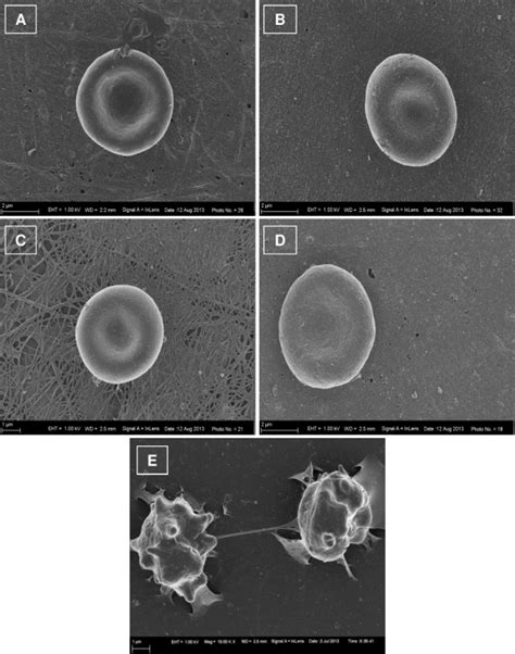 SEM Images Of Erythrocytes After 3 Min Exposure At 22C A Download Scientific Diagram