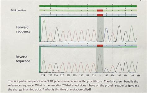 Solved This Is A Partial Sequence Of A Cftr Gene From A